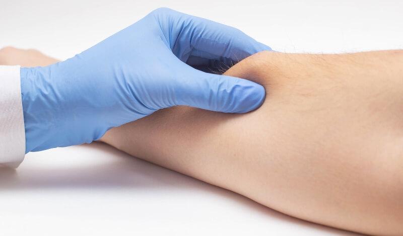 Lipome minimalinvasiv entfernen in Dortmund